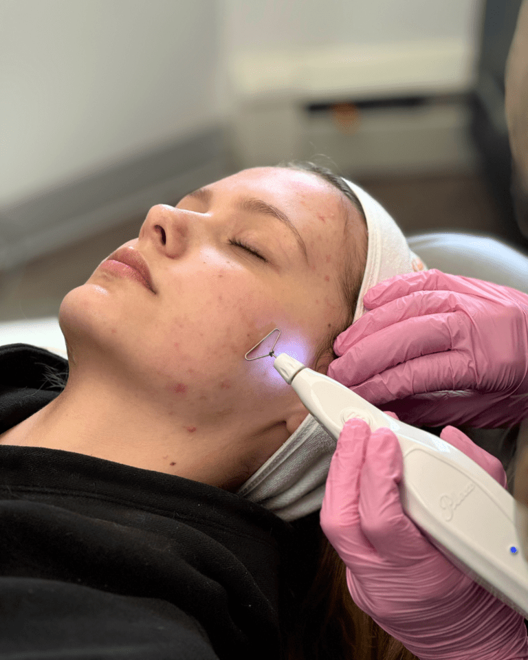 Plexr Plus – Parsons Dermatology & Cosmetics