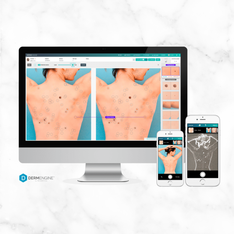 Total Body Photography – Parsons Dermatology & Cosmetics